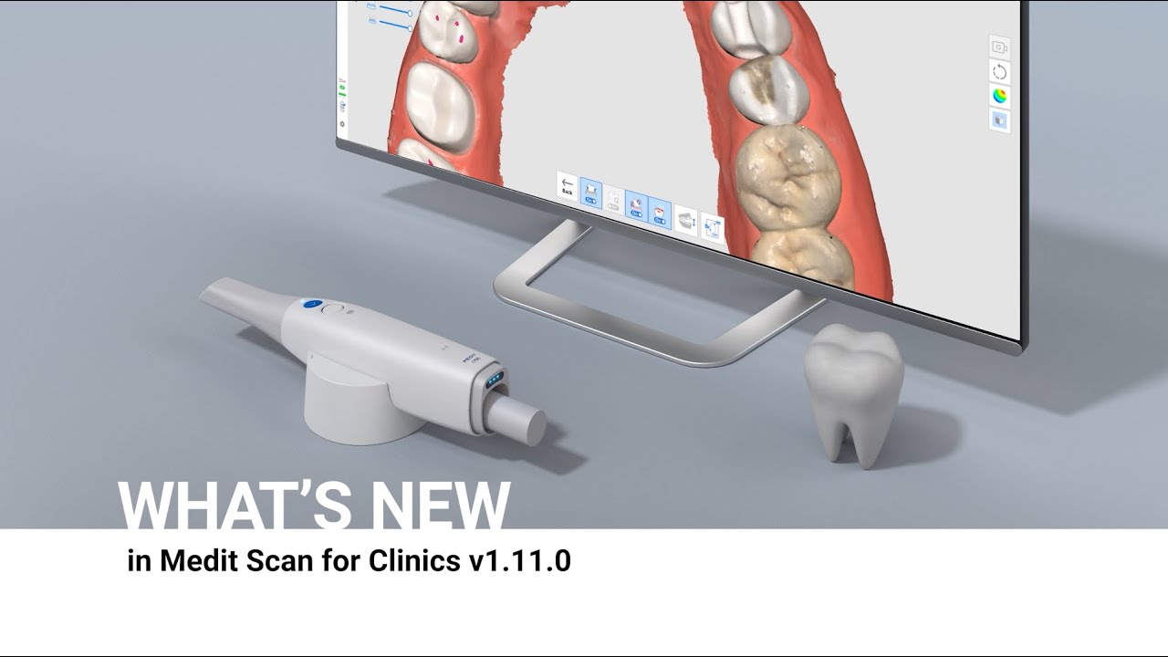 What's new in Medit Scan for Clinics v1.11.0 Beta - YouTube