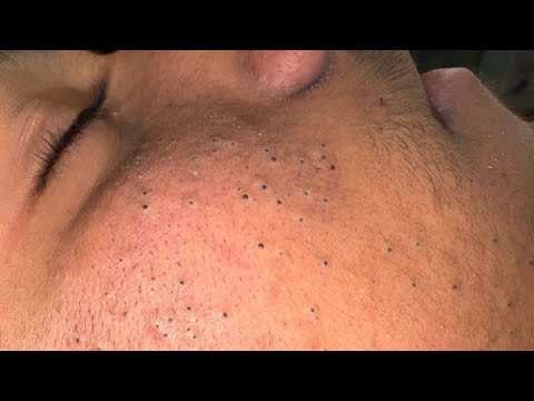 Facial Care Routine vs Skin Tint: What Actually Looks Better on Mature Skin?