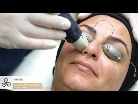 Altin Ütü Uygulaması - Uzm. Dr. Şerafettin Saraçoğlu