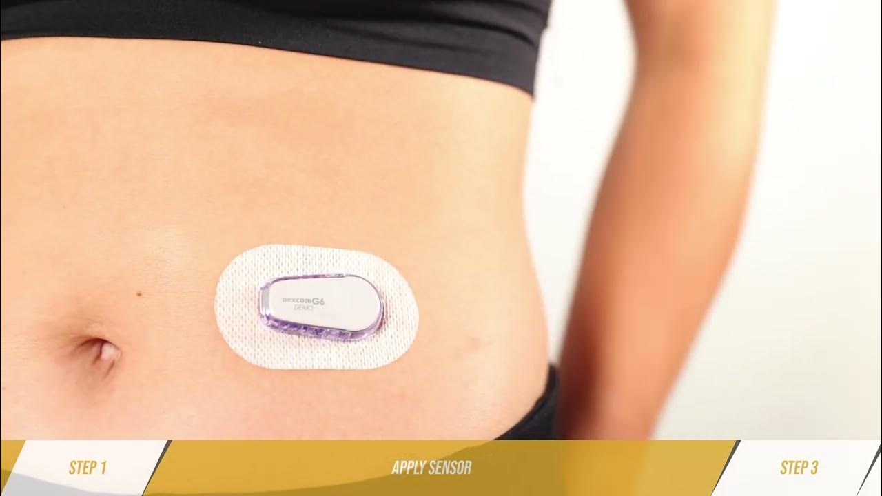How to Apply Skin Grip Dexcom G6 Overpatch - YouTube