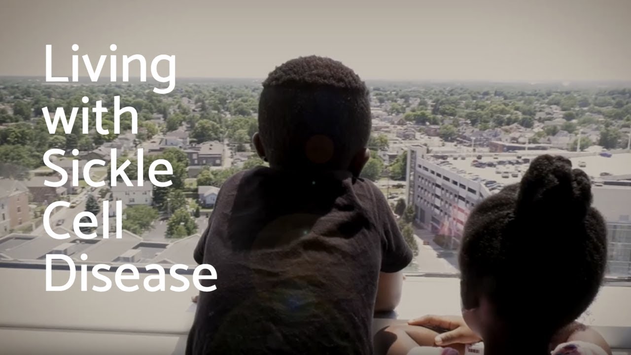 Living With Sickle Cell Disease | Meet Dr. Susan Creary - YouTube