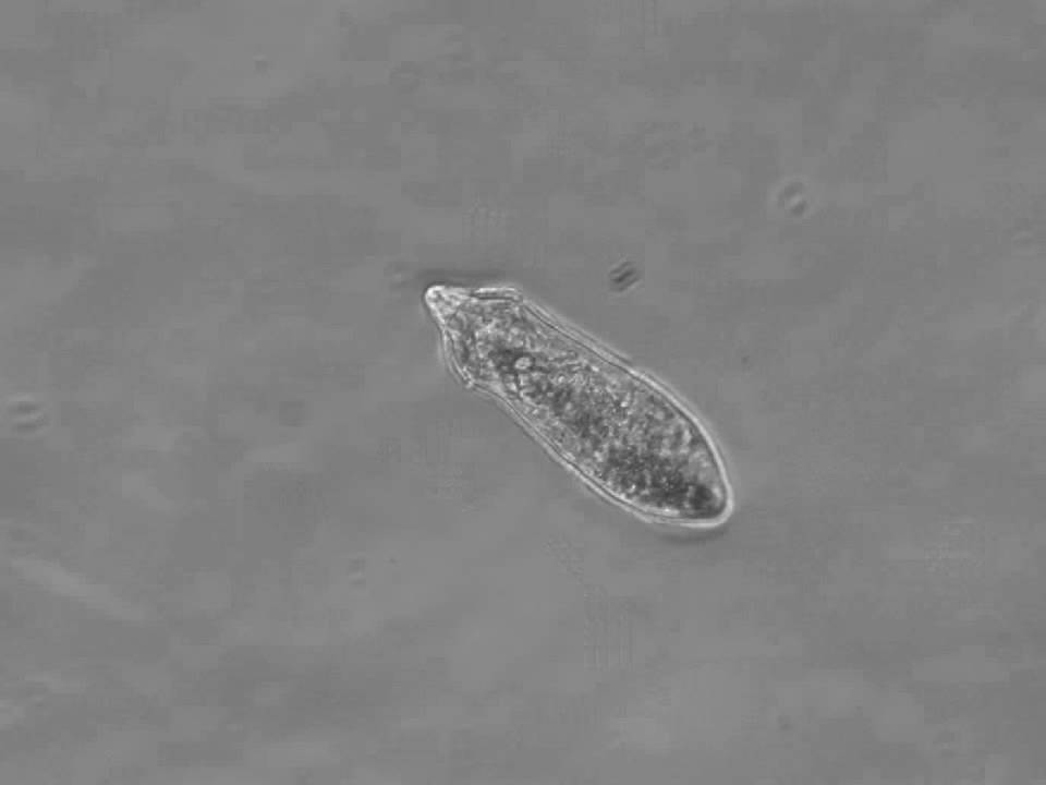 Schistosoma Mansoni Miracidia