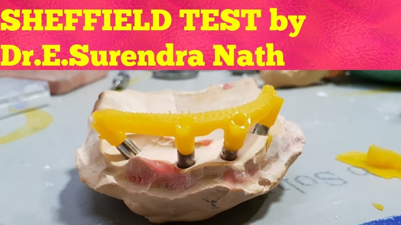 Sheffield test by Dr.E.Surendranath.#allonfour - YouTube