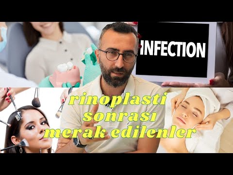 Burun Ameliyatı Sonrası Enfeksiyon, Makyaj Yüz Temizleme, Diş Çekimi...