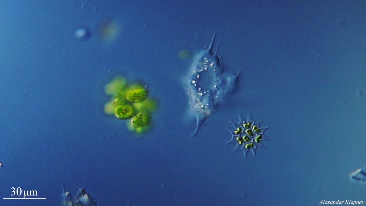 Amoeba and algae - YouTube