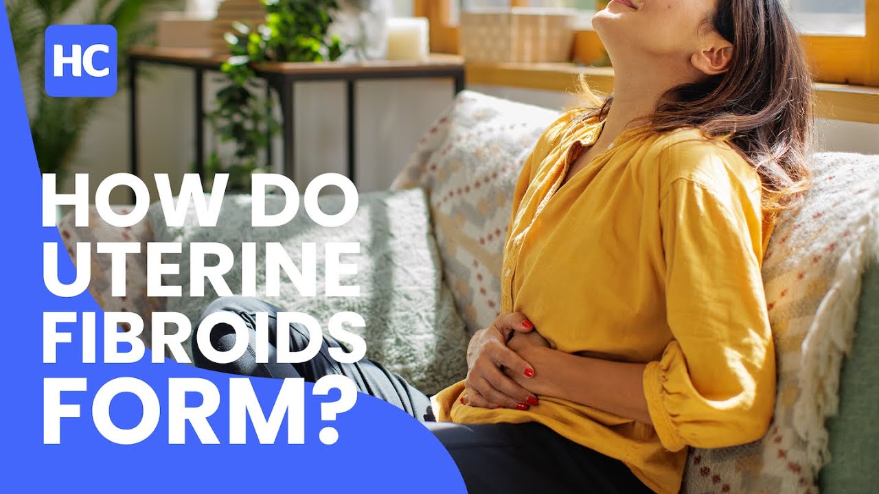 How Do Uterine Fibroids Form? - YouTube