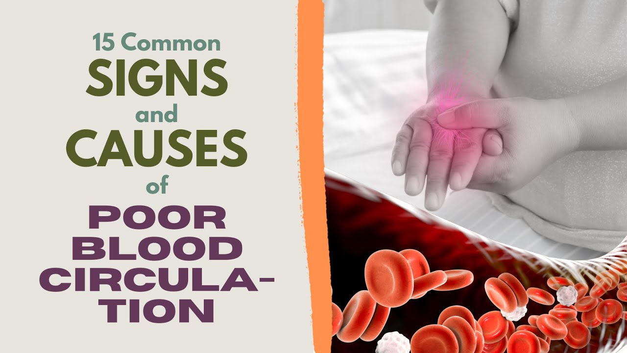 14 Common Signs of Poor Blood Circulation | How to Improve Blood Flow ...