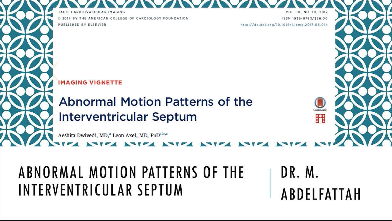 Abnormal motion patterns of the interventricular septum - YouTube