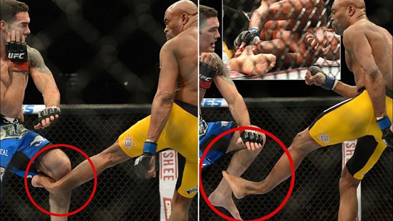 Anderson ‘Spider’ Silva’s Leg fracture by @FighterpreneursLife - YouTube