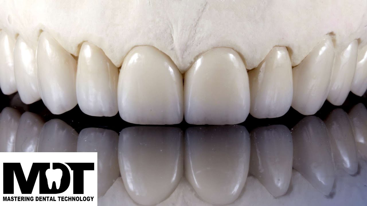 Contouring Ceramic Crowns - Step by Step Guide For The Perfect Smile ...