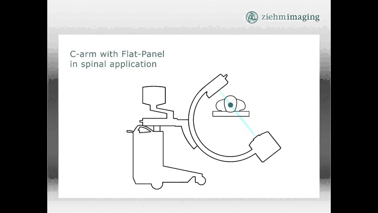 C-arm with Flat-panel in spinal application - YouTube
