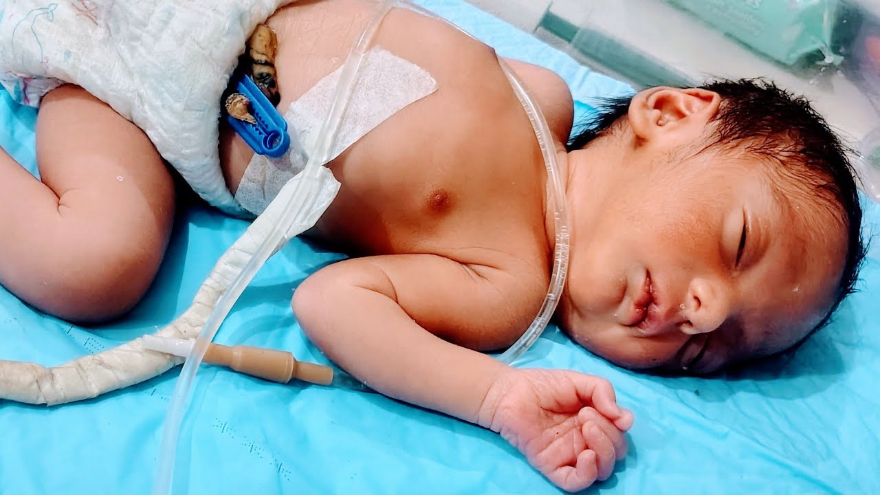 Premature Baby Pritam’s Active Moments 🥰 | Cute Preemie Baby Sleeping ...