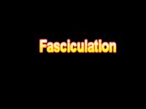 What Is The Definition Of Fasciculation - Medical Dictionary Free ...