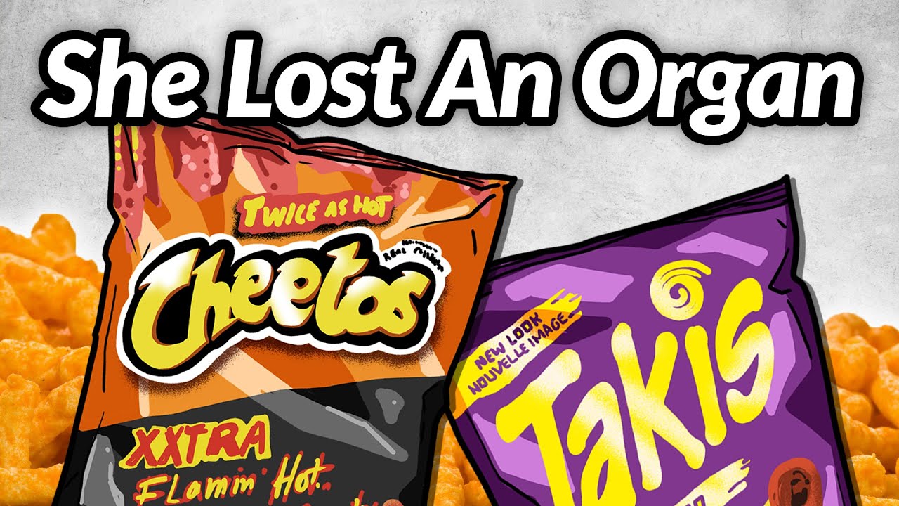 Girl Loses Organ After Eating Flamin Hot Cheetos This Is Why YouTube