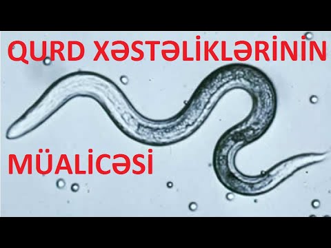 Qurd xəstəliklərinin təbii yolla müalicəsi