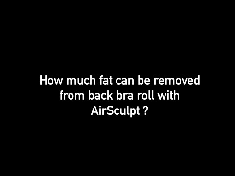 FAQ- Bra Roll - How much fat can be taken from back bra roll?