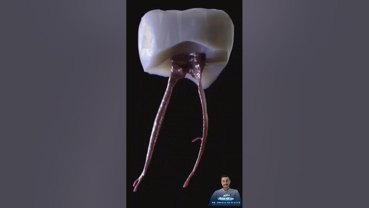 هل شاهدت من قبل شكل العصب من داخل الضرس؟|| - YouTube