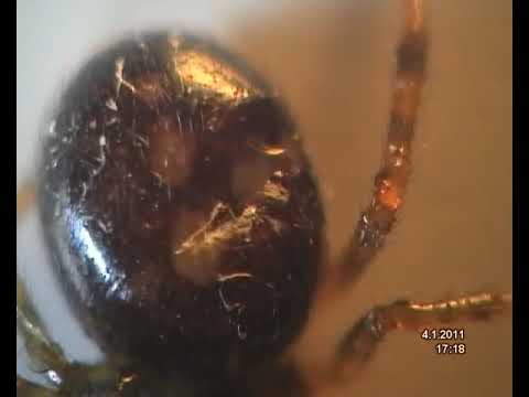 Tiny Spider Dissection - YouTube