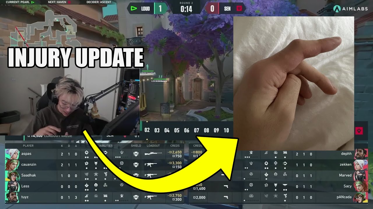 TenZ Gives An Update On His Finger Injury - YouTube