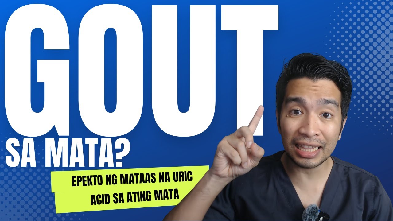 GOUT AT ANG MATA. EPEKTO NG MATAAS NA URIC ACID SA MATA - YouTube