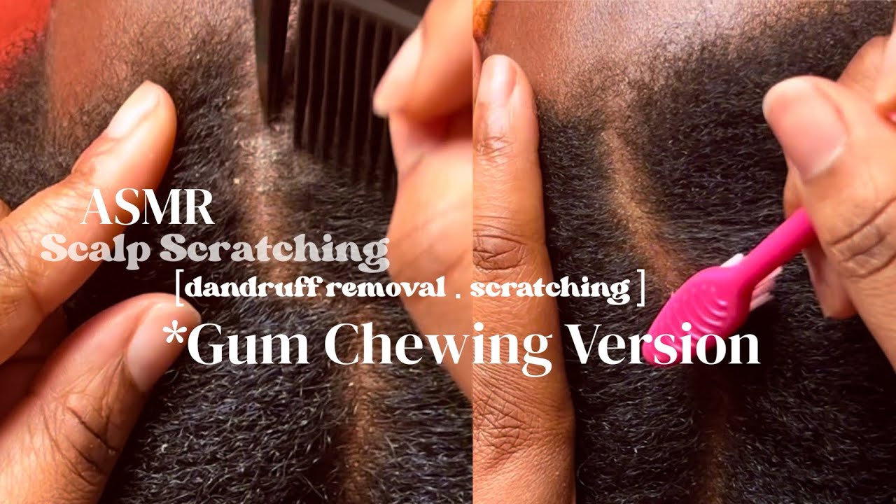ASMR GUM CRACKING Scalp Scratching to Help You SLEEP - YouTube