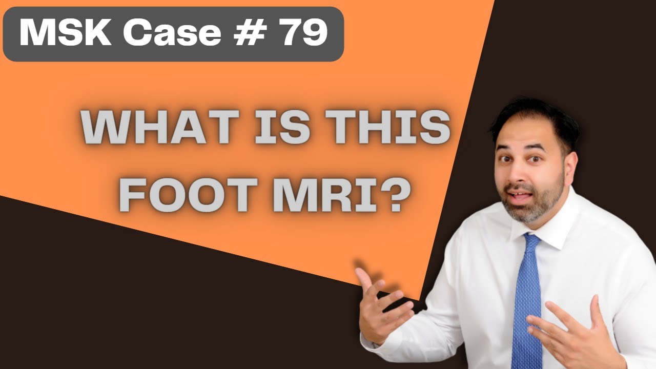 MSK CASE #79- Amazing MRI Foot Case! - YouTube