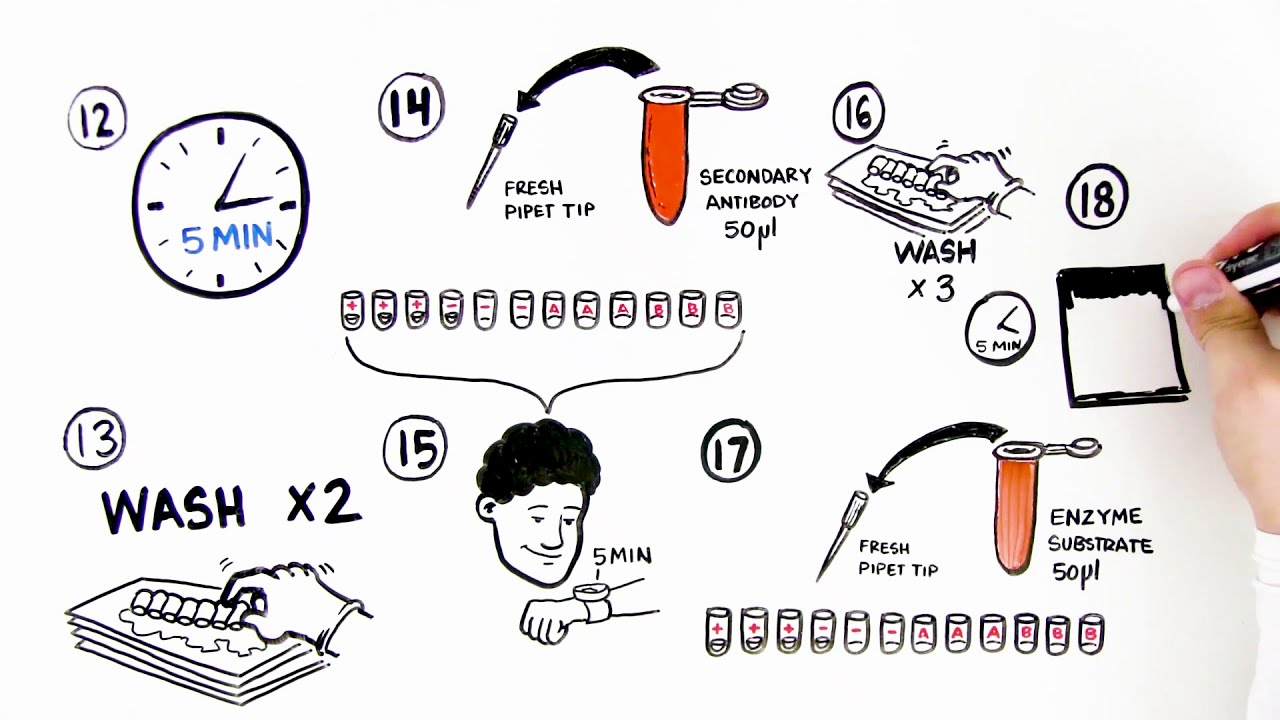 ELISA Immuno Explorer Kit Student Activity Video Quick Guide - YouTube