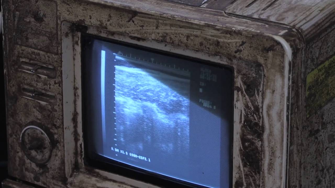 Donnie Robertson - Ultrasound for Carcass Traits in Cattle - Measuring ...