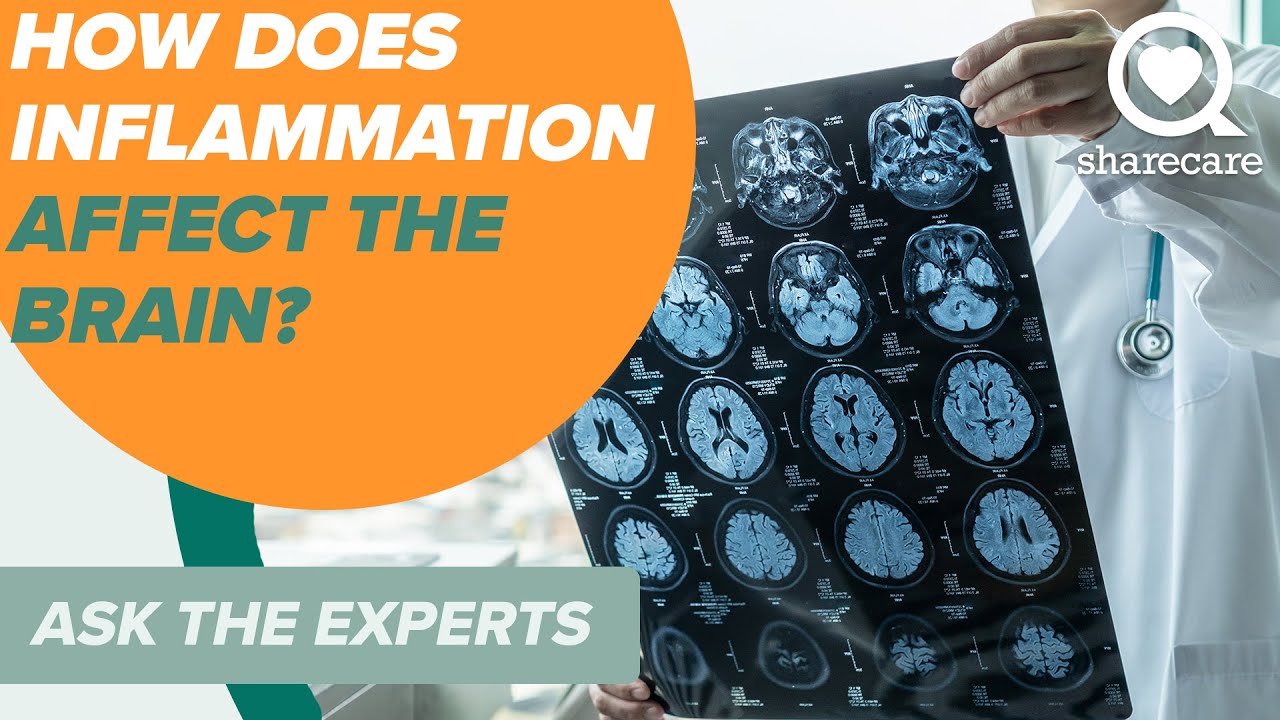 Inflammation and the Brain: What You Need to Know | Ask The Experts ...
