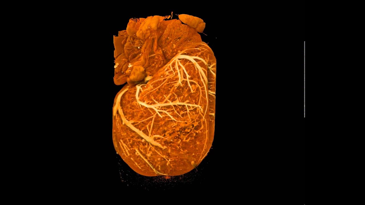 Rat heart 3D x-ray Australian Synchrotron IMBL - YouTube