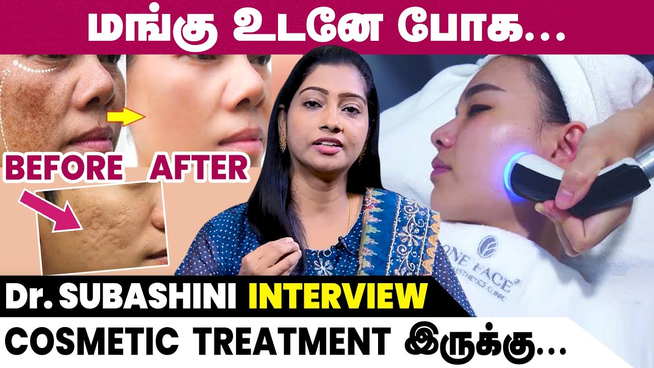 Vampire Facial பண்ணா Permanent Glowing Skin கிடைக்கும் - Dr. Subashini Reuban - YouTube