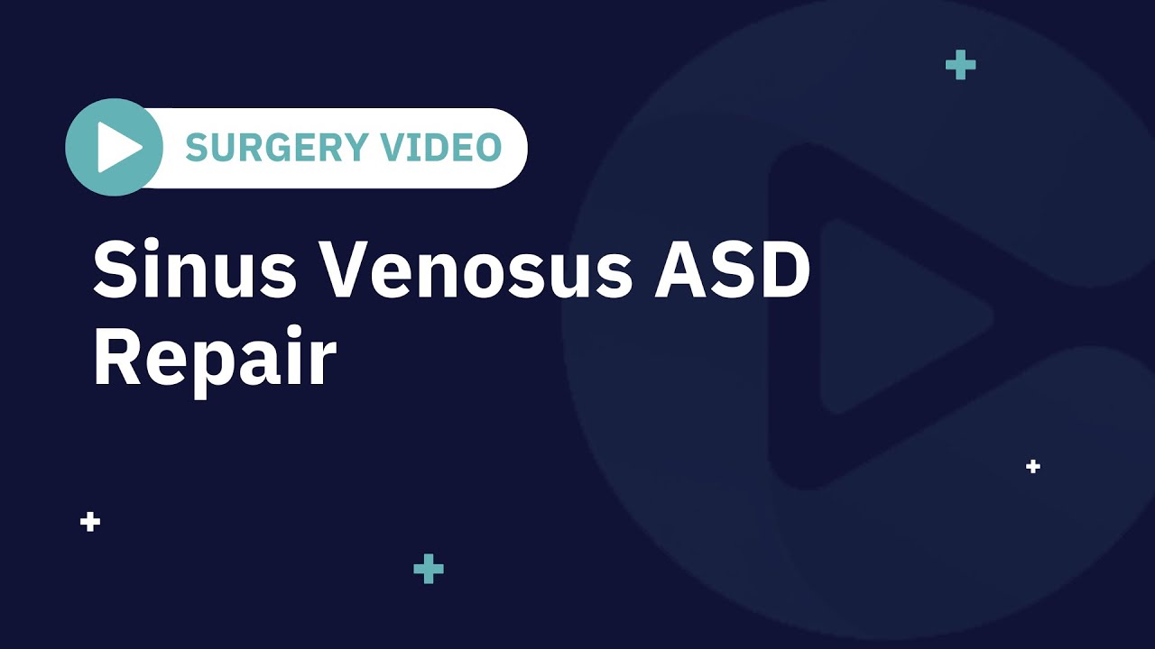 Surgical Video: Sinus Venosus ASD Repair - YouTube