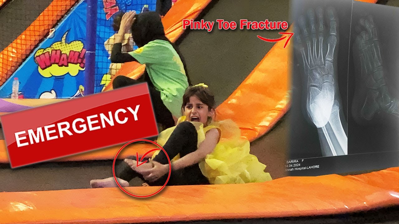 Trampoline Accident | BOUNCE @ SUPER SPACE Accident | Toe Fracture ...
