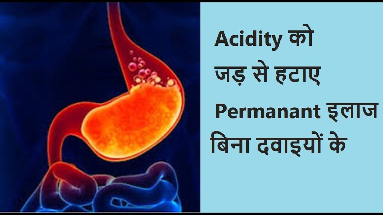 Permanent Solution How to Remove ACIDITY# Acidity ko kaise hataye# natural way to remove acidity ...