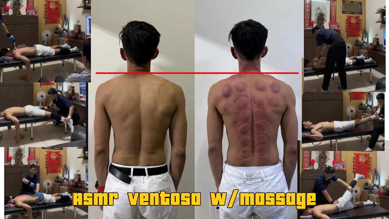 Asmr ventosa w/massage - YouTube