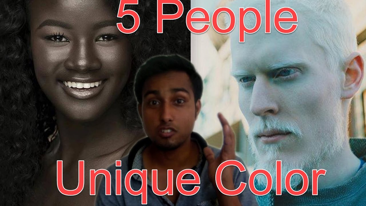 5 People with Unique Skin Color Reaction - YouTube