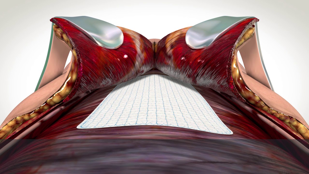 OviTex Video - YouTube