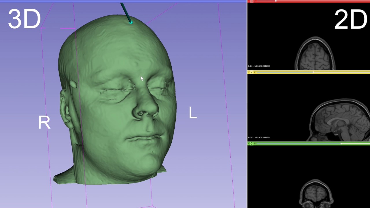 NeuroMap Debut Video - YouTube