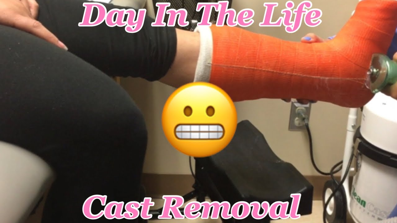Day In The Life Of A Caring Mom | Leg Cast Removal | Life With Missy ...