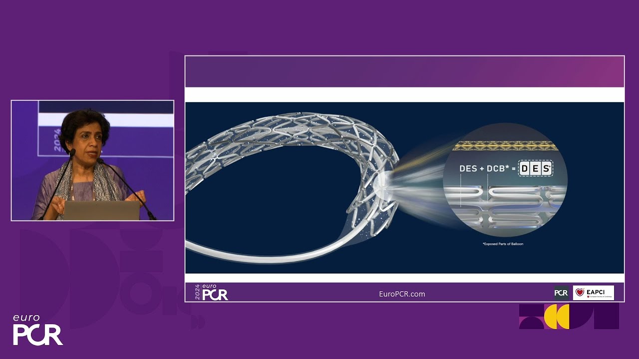 PCI in patients with diabetes: next generation DES + DCB stent platform ...