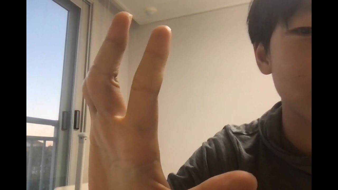I Have Finger Mutation - YouTube