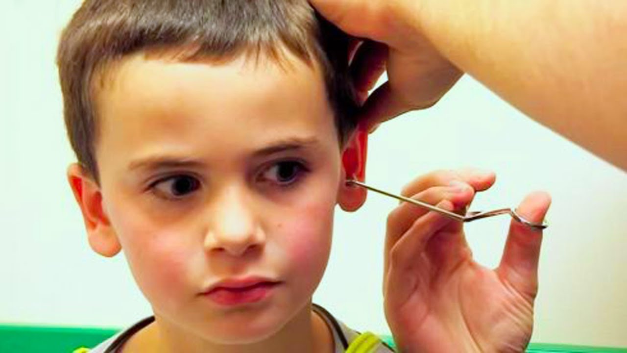 When This Boy Says He Got Pencil Stuck in His Ear, Then Doctor Pulls ...