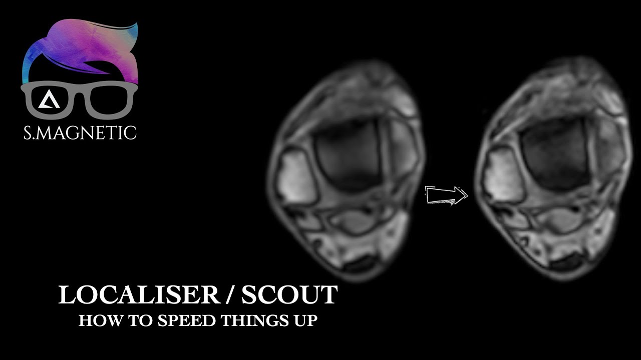 LOCALISER/ SCOUT. HOW TO SPEED THINGS UP - YouTube