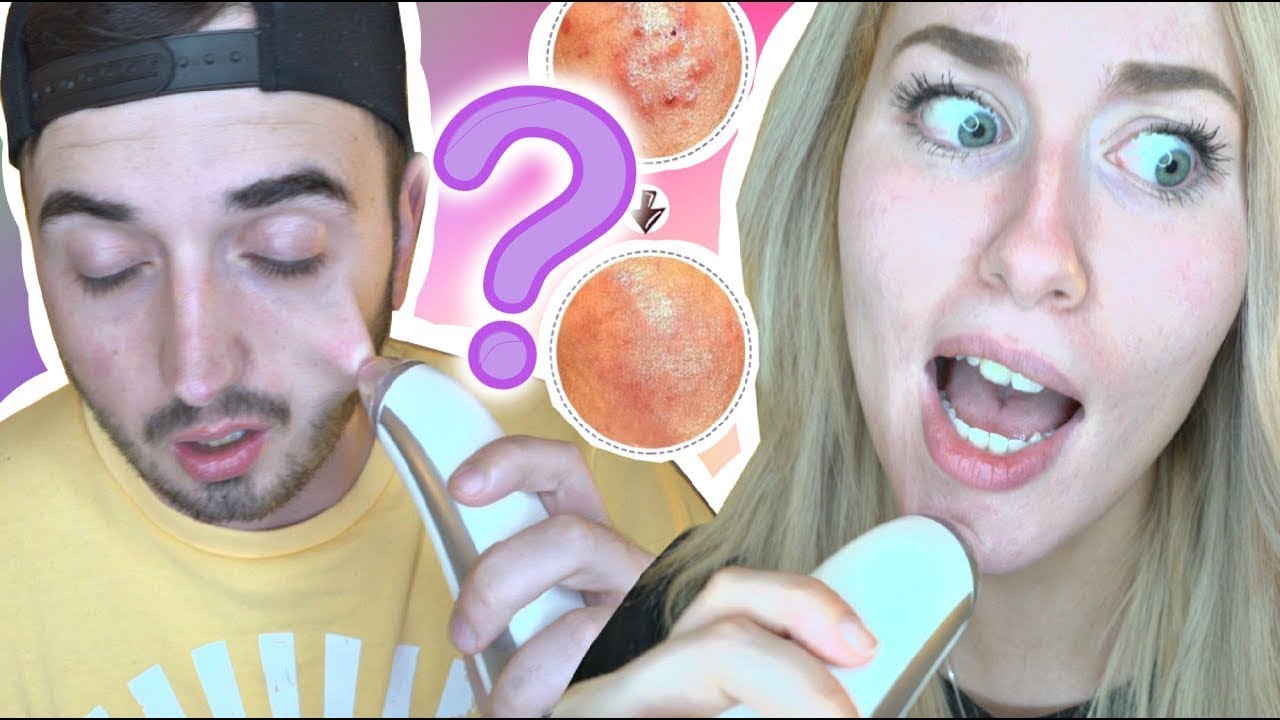 PICKEL ABSAUGEN mit DIESEM DING?! Marcel & Ich testen ob das ...