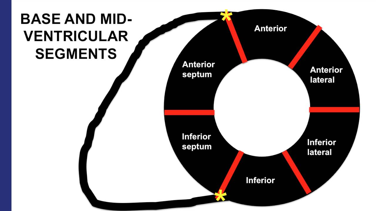 Cardiac Segmentation - YouTube