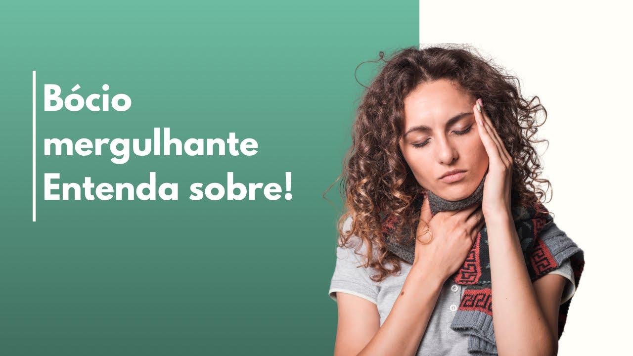 Bócio mergulhante, TUDO que você precisa saber! - YouTube