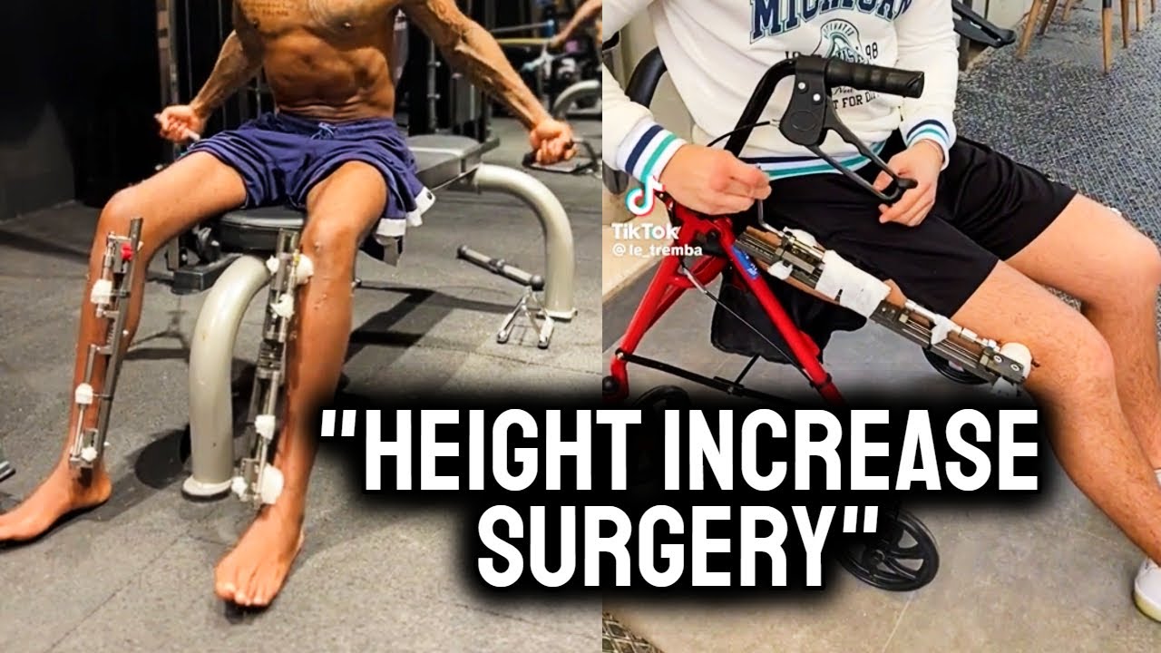 "Leg lengthening surgery💀" - YouTube
