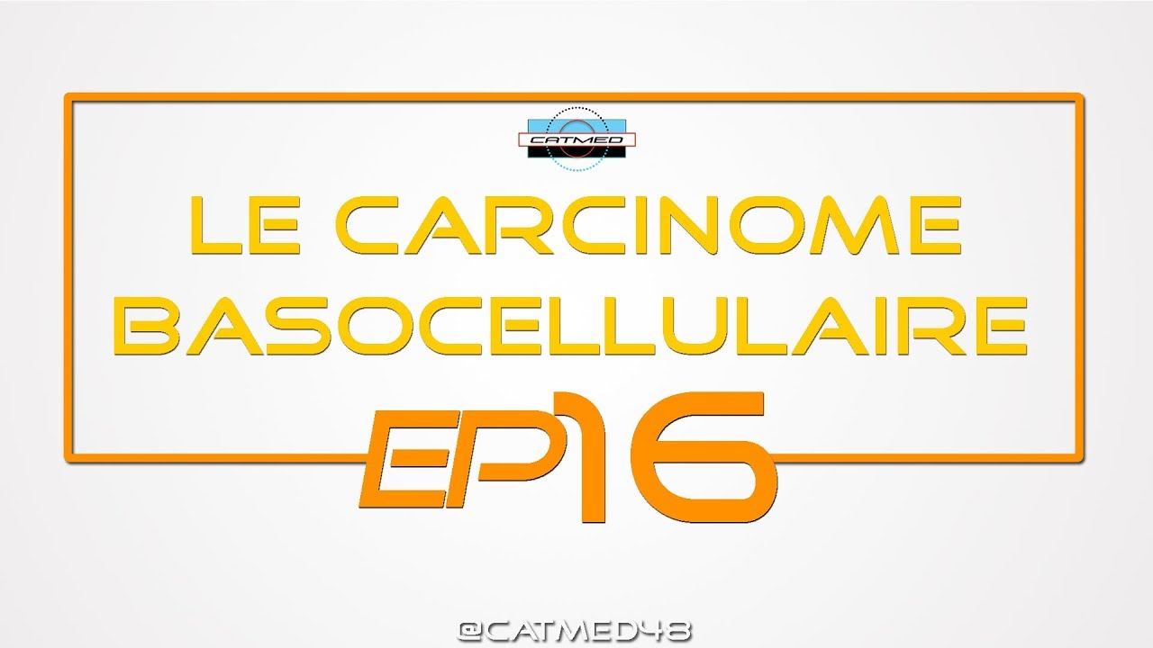 DermaCat #16 : Les Carcinomes Basocellulaires (CBC) - YouTube