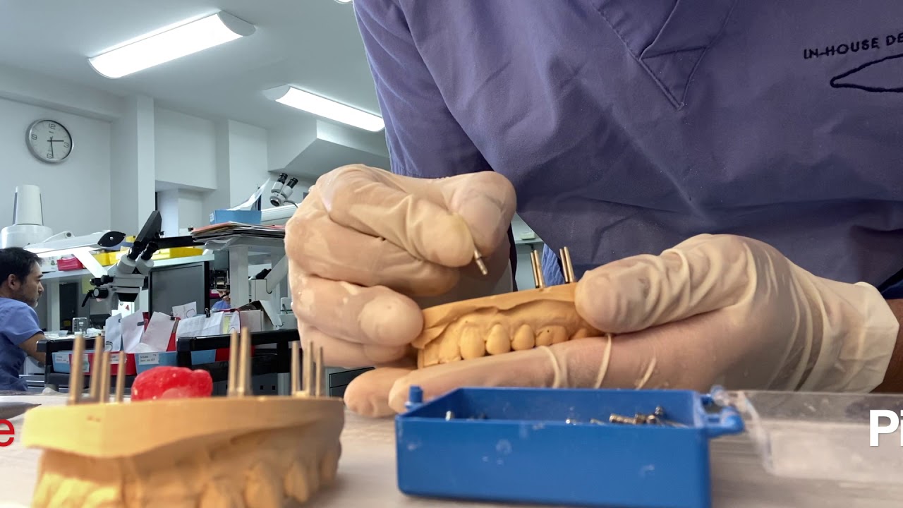 Dental Model Fabrication - YouTube