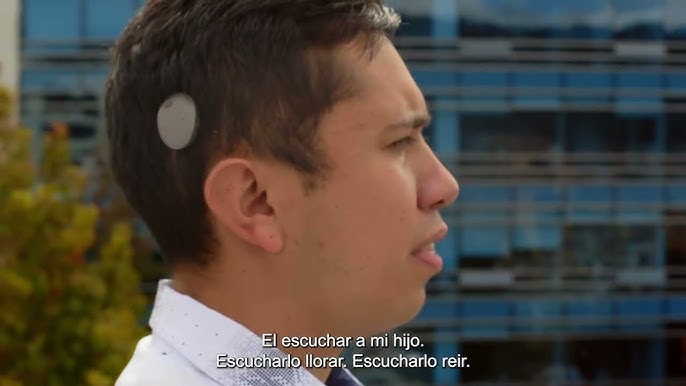 Cochlear Osia System—implantable Bone Conduction Hearing